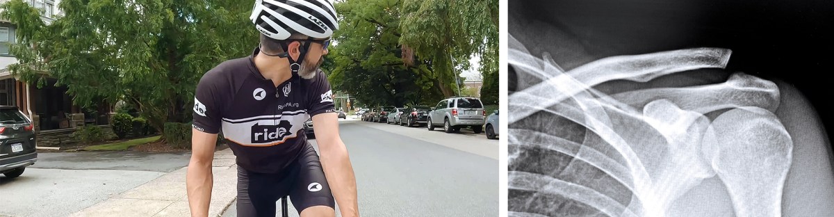 Riding with a separated shoulder. Injury timeline, recovery, and ...